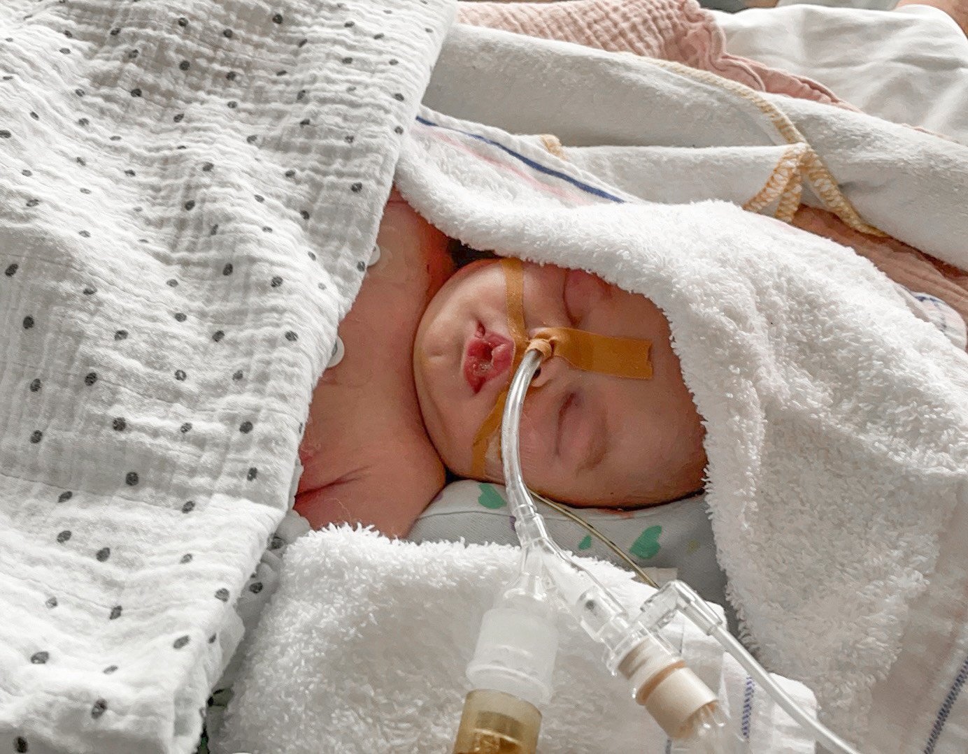 De dag dat ze besloten Sarah te opereren (deel 2) – Stichting Nooit Voorbij